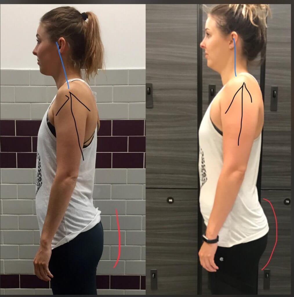 Ergonomics for Dental Practices | Ergo Fit Life | Personal Training